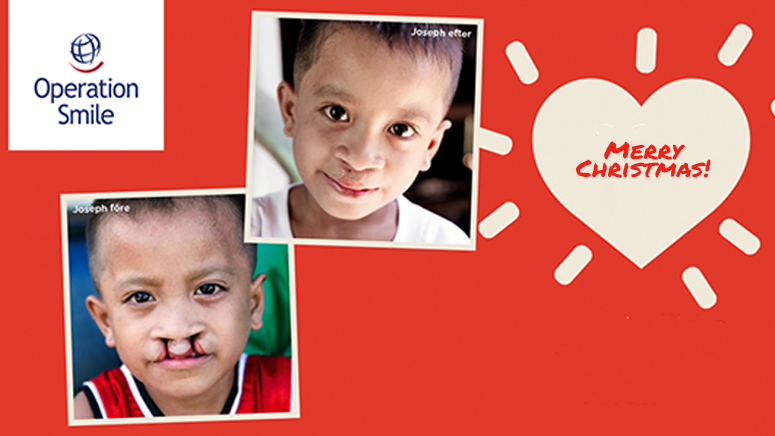 新年礼物——支持Operation Smile - 博壳松包装